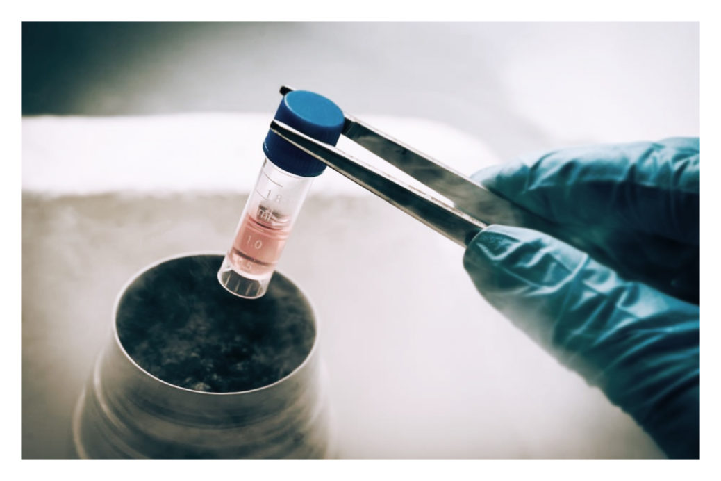 Fertility preservation - Dr Psathas